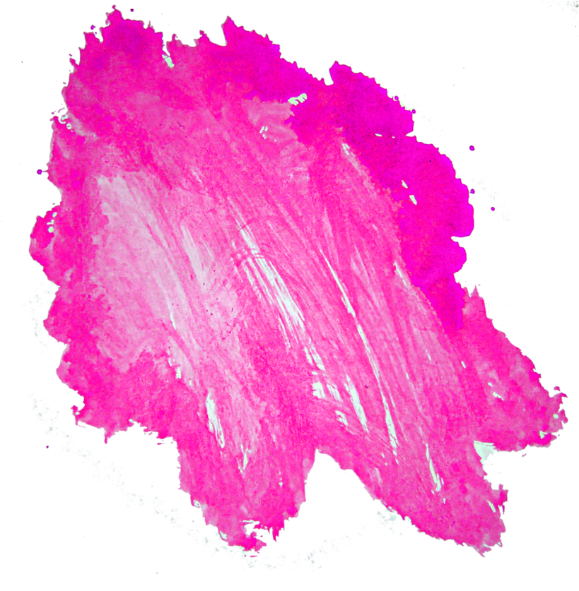 Download Pink Stain Free Png - Pink Stain | Transparent PNG Download ...