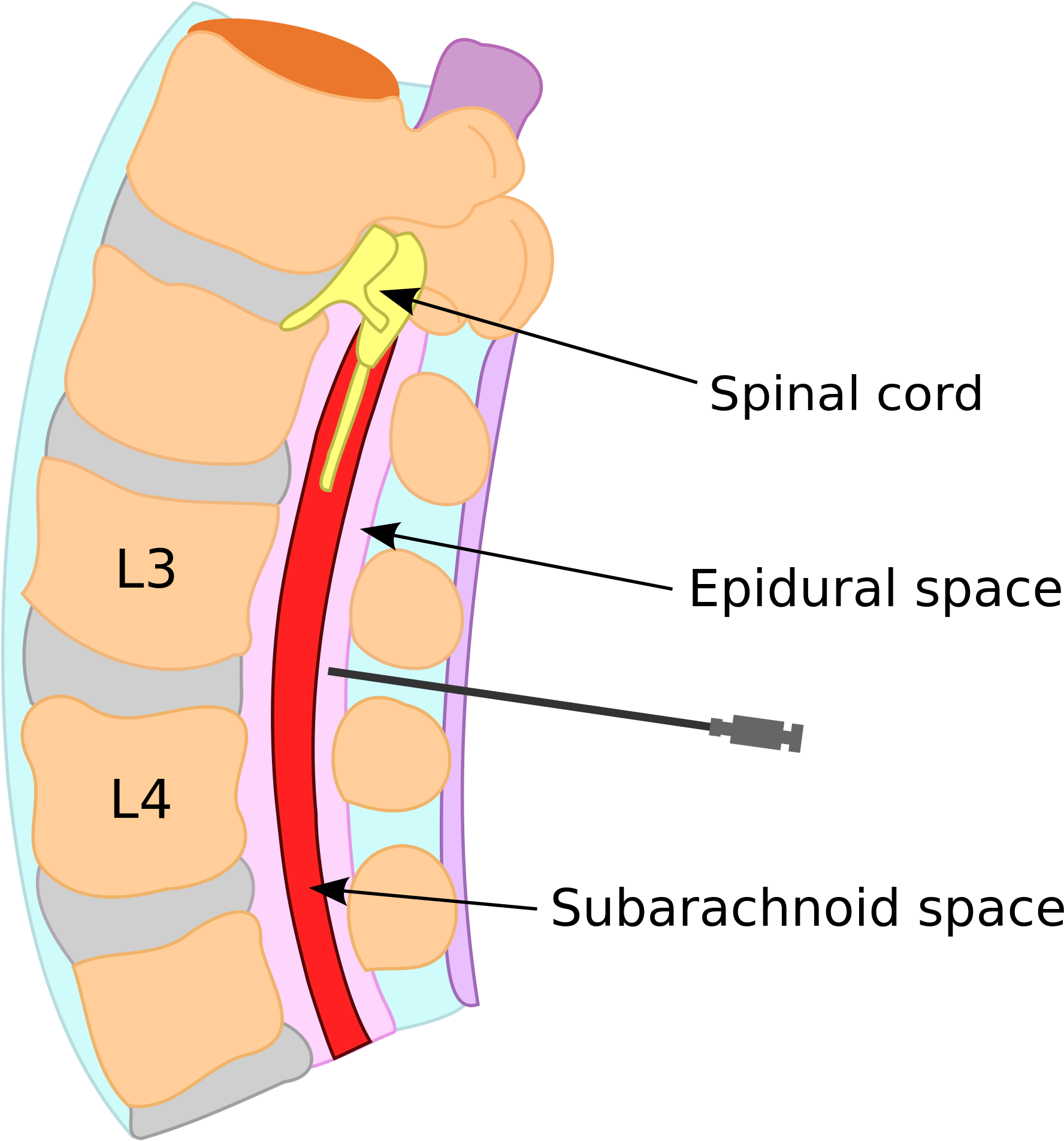 By Allison Wallis - Csf And Epidural Space (2000x2000), Png Download