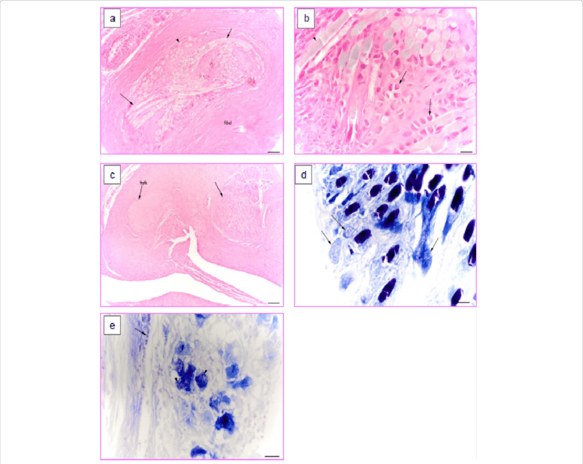 In The Long Axis (arrows) And Cross Section (arrowhead) - Cell (850x676 ...