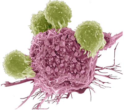 Download T-cells Attacking A Cancer Cell - Sem Of B Lymphocyte ...