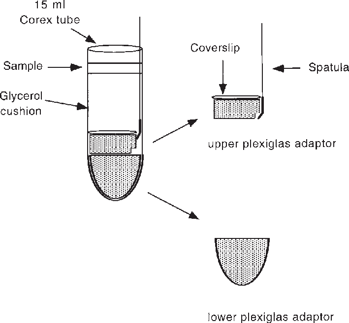 Drawings Showing The Setup For Spinning Down Spindle - Drawing (709x657 ...