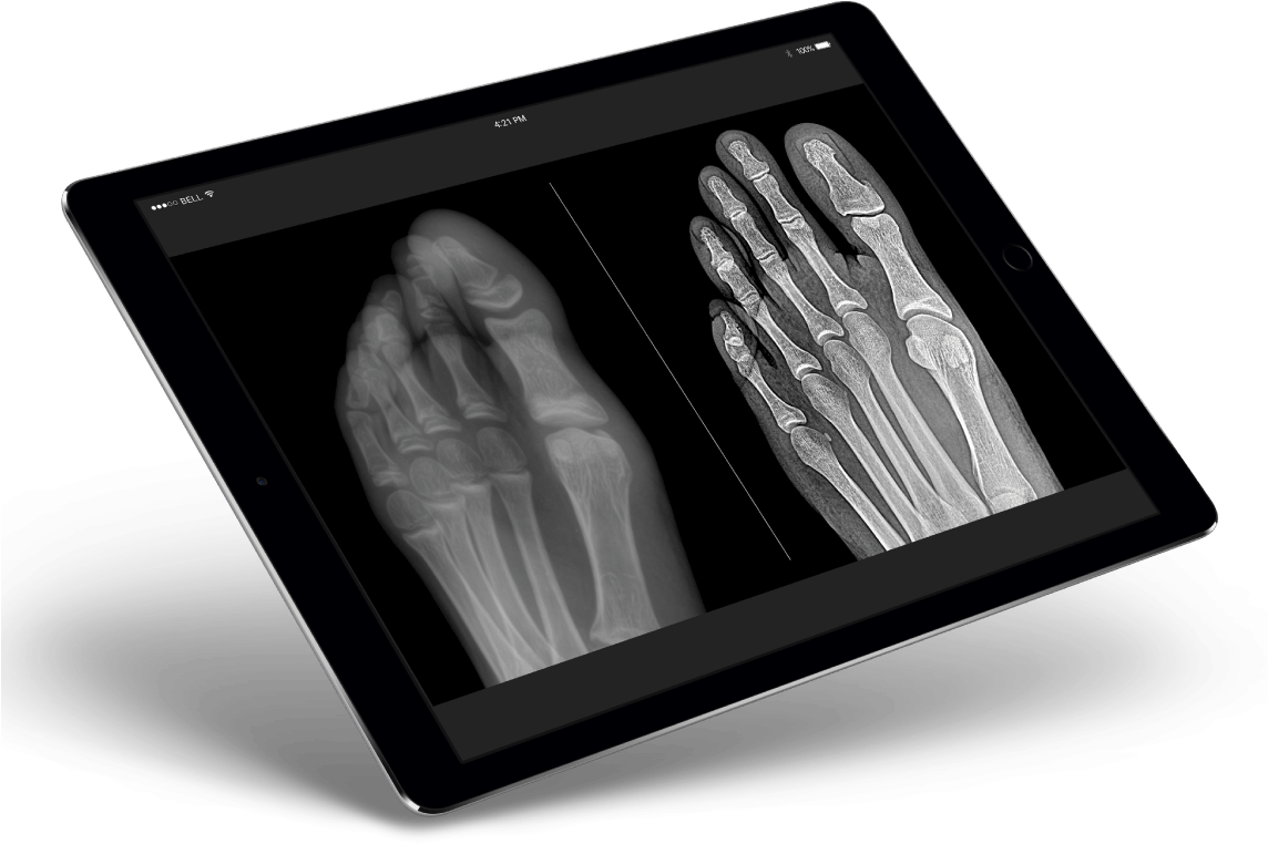 The Most Adaptive Dr System In The World - Radiography (1143x864), Png ...