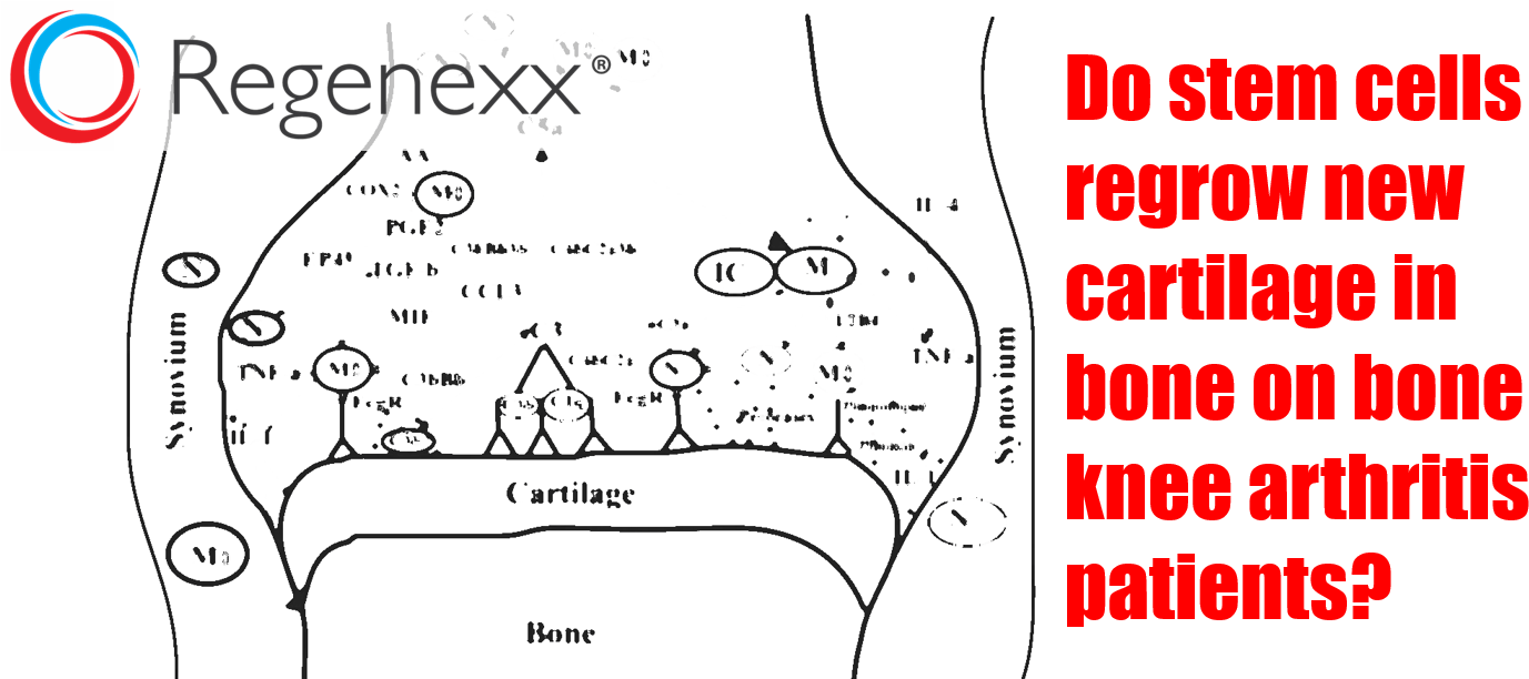 Bone (1477x618), Png Download