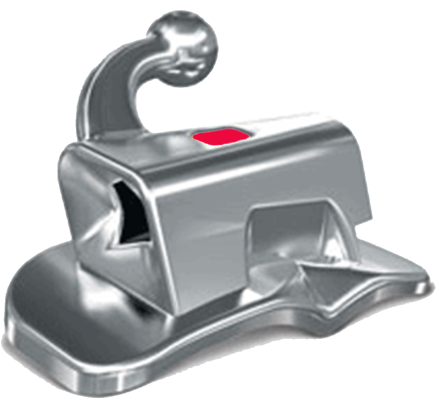 Funnel tube Molar 928x785 Png Download funnel-tube-molar-928x785-png-download