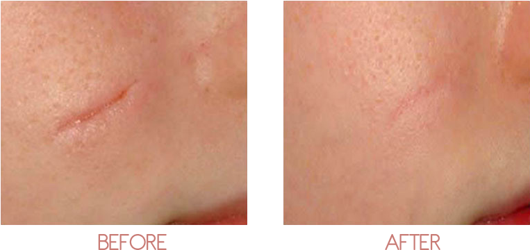 Scar (800x400), Png Download