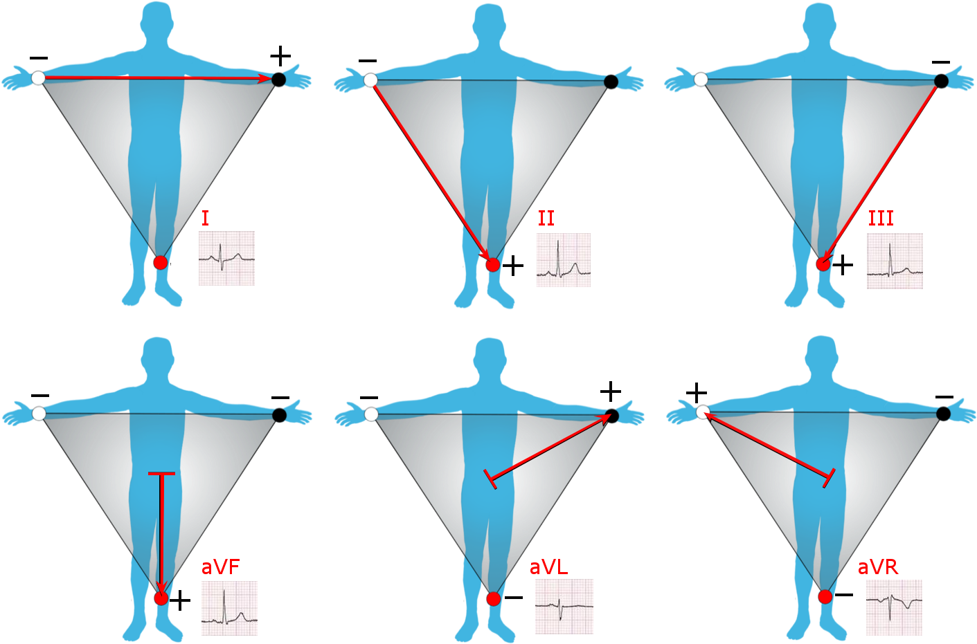 Limb Leads Of Ekg - Limb Leads Of Ecg (1500x1000), Png Download