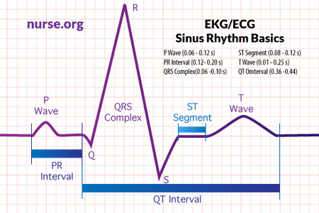 Normal Ecg Graph - Plot (450x300), Png Download