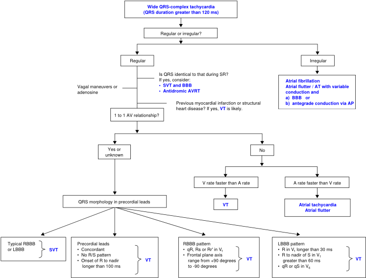 The Acc Algorithm [1] - Ventricular Tachycardia (800x633), Png Download
