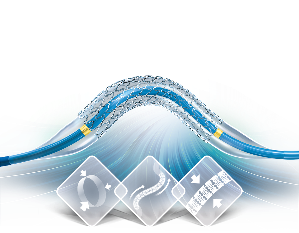 Download Cobalt-chromium Endovascular Stent System | Transparent PNG ...
