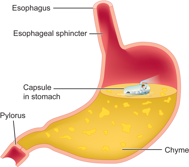 Chyme - Stomach Chyme (800x695), Png Download