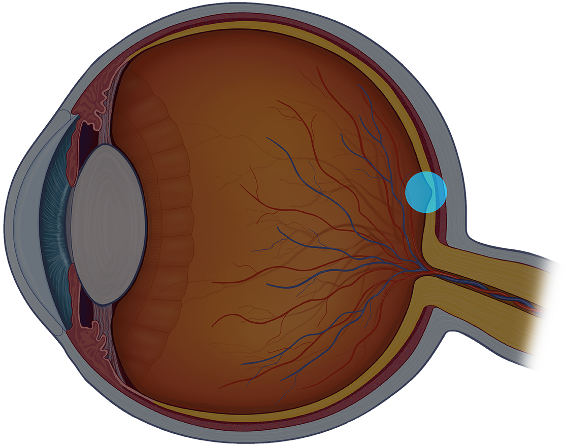 The Fovea Centralis Is A Small Area Of The Retina Where - Cross Section ...