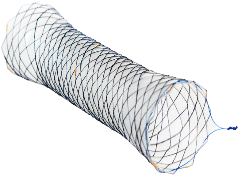 Ccba Covered Colorectal Stent With Lasso - Bare-metal Stent (992x817 ...
