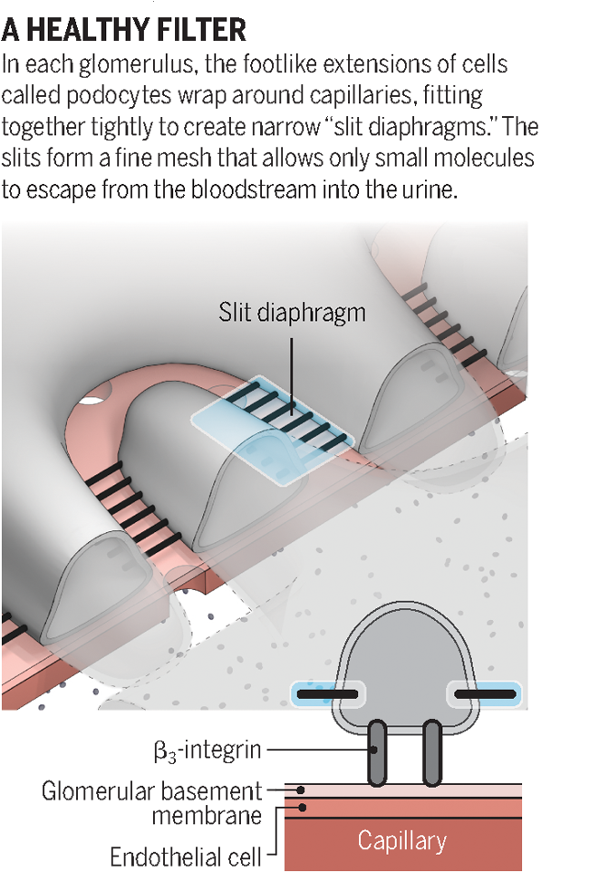 Supar And Kidney Disease - Aerospace Engineering (750x1000), Png Download