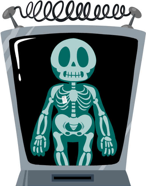 Xray - X Ray Png (555x668), Png Download