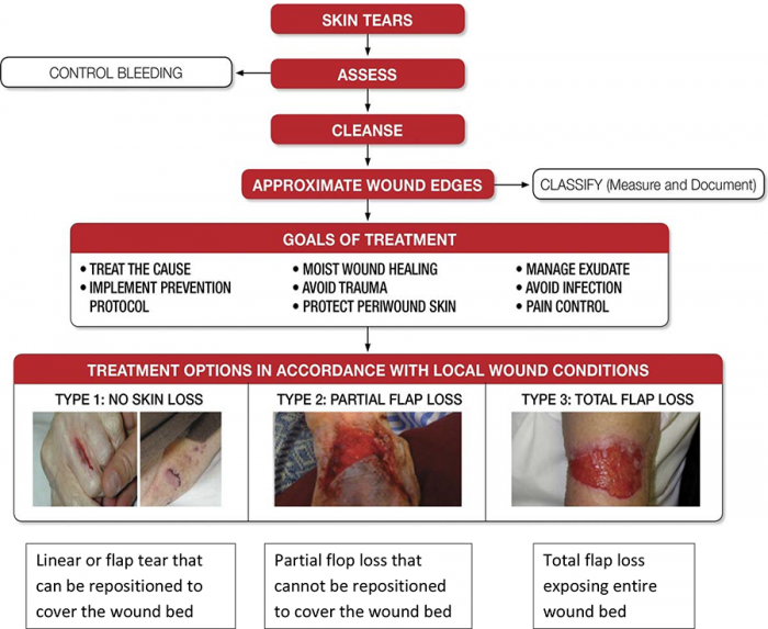 Decision Algorithm - Star Classification Skin Tears (700x573), Png Download