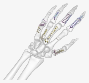 See All Images - Bone Hand PNG Image | Transparent PNG Free Download on ...