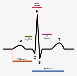 File Sinusrhythmlabels Svg Nursing Pinterest Explore - Qt Interval PNG ...