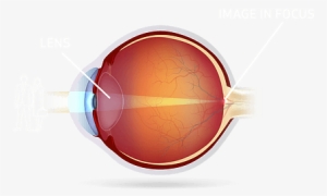 Normal Clear Lens - Globe PNG Image | Transparent PNG Free Download on ...