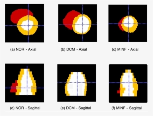 The Figures Shows The Short Axis Cardiac Segmentation - Circle PNG ...