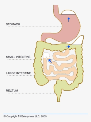 Trapped Gas Causes Blockages And Bloating In The Intestines - شكل ...