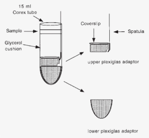Drawings Showing The Setup For Spinning Down Spindle - Drawing PNG ...