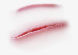 Scar PNG Images | PNG Cliparts Free Download on SeekPNG