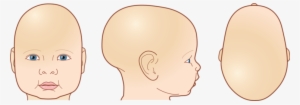 Scaphocephaly-example - Long Back Of Head PNG Image | Transparent PNG ...