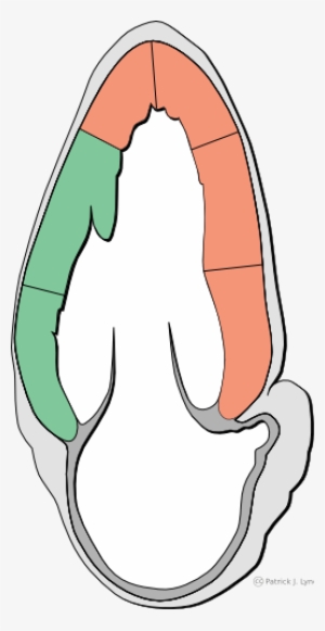 An Apical Two Chamber View Of The Heart - 2 Chamber Heart Cs PNG Image ...