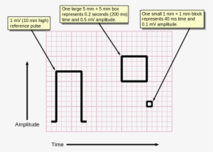Ecg Paper V2 - Ecg Graph Paper PNG Image | Transparent PNG Free ...
