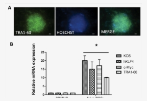 Reprogramming Example Of Peripheral Blood Mononucleated - Diagram PNG ...