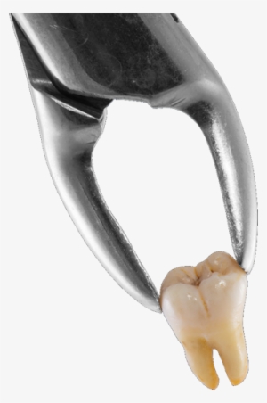 Tooth Extractions - Wayne, Nj - Dental Extraction PNG Image ...