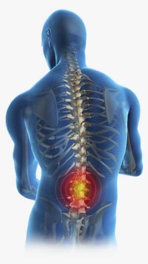 Lower Back Pain PNG Image | Transparent PNG Free Download on SeekPNG