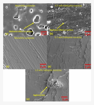Sem Images Of Fractured Surface - Bone Fracture PNG Image | Transparent ...