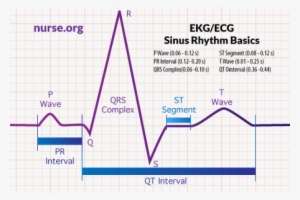 Normal Ecg Graph - Plot PNG Image | Transparent PNG Free Download on ...