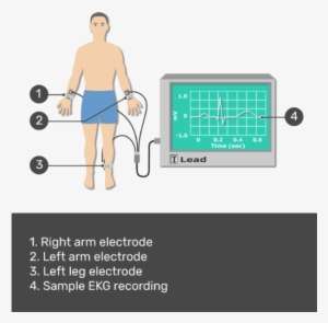 Distribution Of Coronary Perfusion And The Ecg - Ecg Coronary Arteries ...