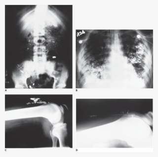 Radiology - Radiation Signage PNG Image | Transparent PNG Free Download ...