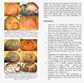 Rye Flower Pollen PNG Image | Transparent PNG Free Download on SeekPNG