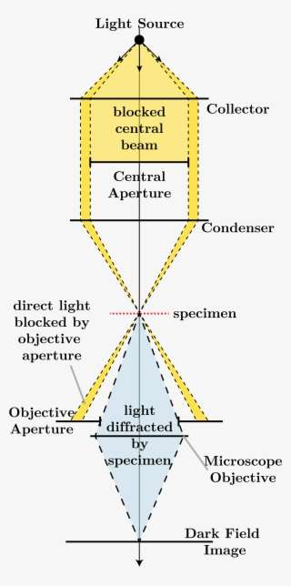 2000px-dark Field Microscope @d - Dark Field Microscopy Diagram PNG ...