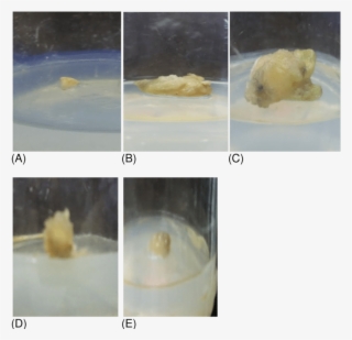 Callus Induced From Shoot Tip Explants By Ms Medium - Batter PNG Image ...