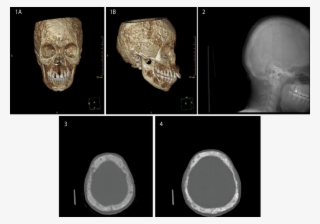 This Is A Frontal 3d Reconstruction View Showing Multiple ...