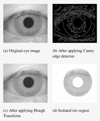 Segmentation Process Of An Iris Recognition System - Segmentation For ...