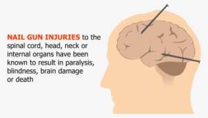 Nail Gun Injuries To The Spinal Cord, Head, Neck Or - Injury PNG Image ...