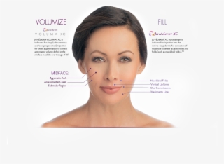 How Png Bruise Juvederm - Freckle PNG Image | Transparent PNG Free ...